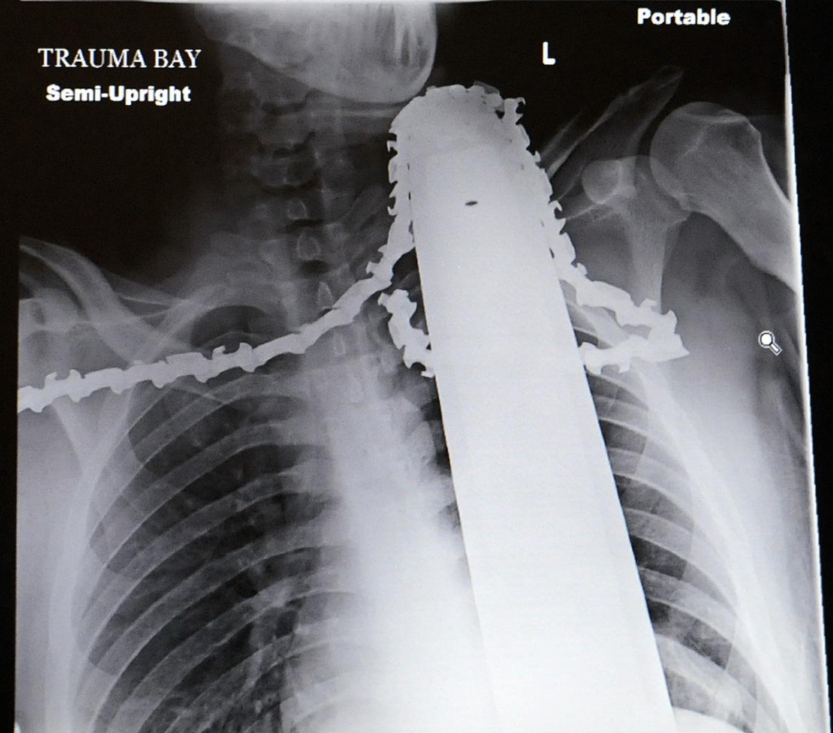 Lumberjack: America's Deadliest Profession